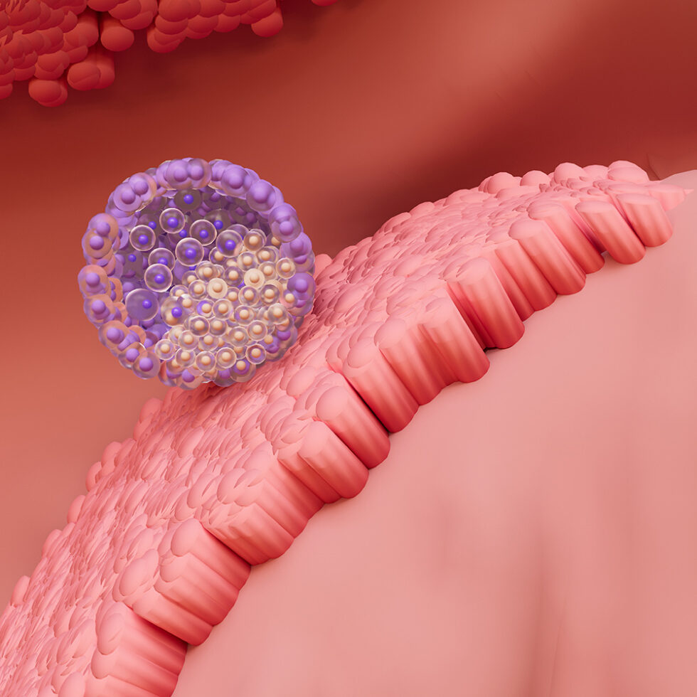 Genetic test of endometrial microbiome | Centro Médico Manzanera